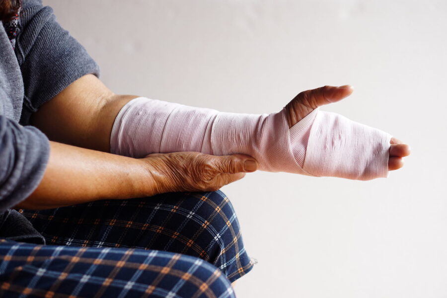 Treating Fractures of All Types and Severities - Liva Hospital
